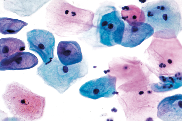 Kalendergewinnspiele - VDCA